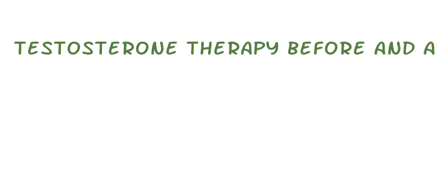 Testosterone Therapy Before And After Pictures - Fuyao Glass America